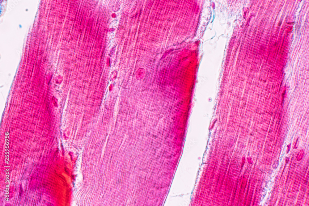 Education anatomy and Histological sample Striated (Skeletal) muscle of ...