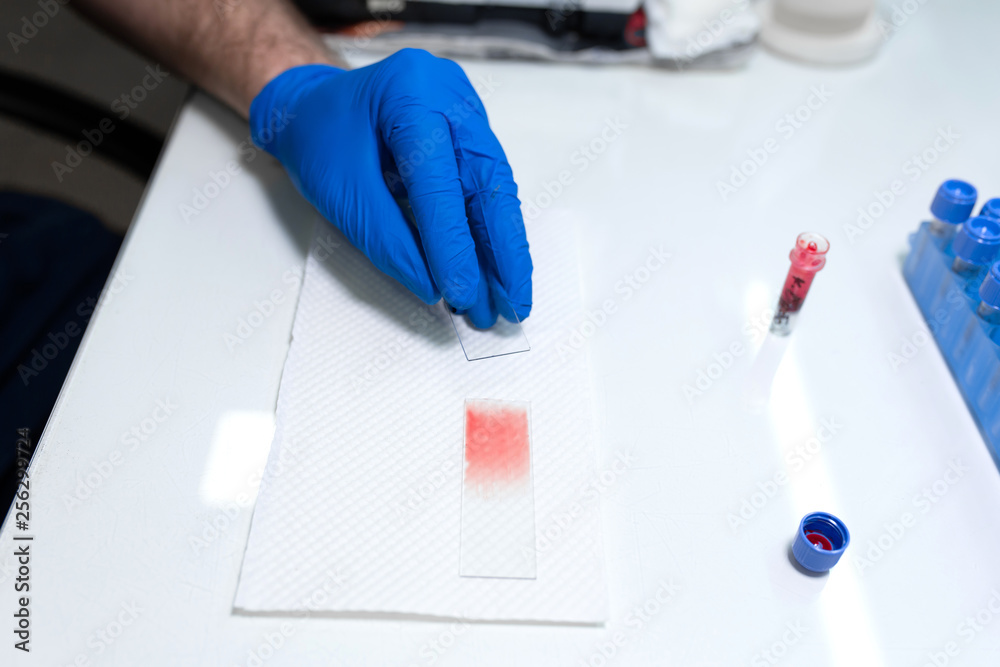 scientist prepare blood sample for research on microscope. Placing ...