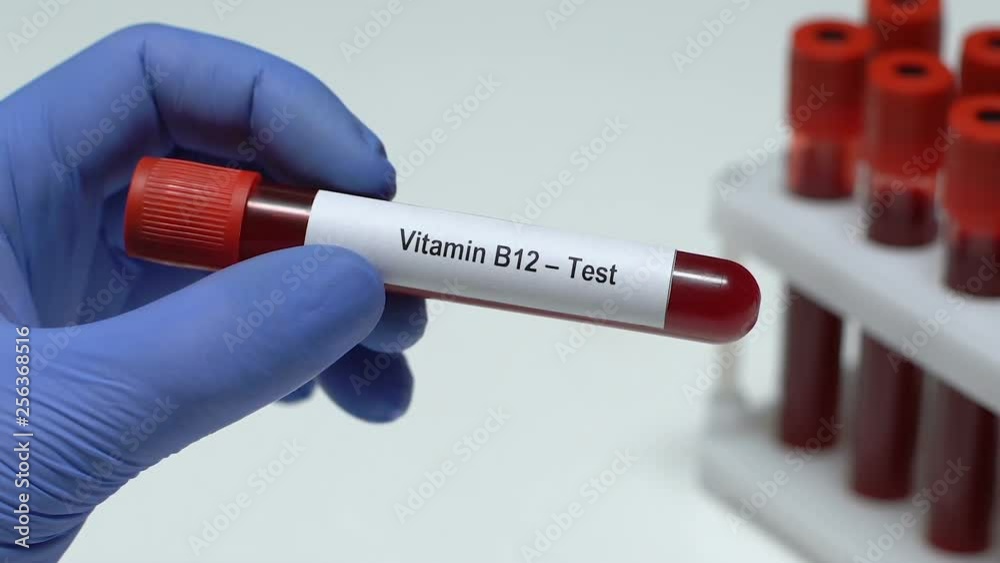Vitamin B12-Test, doctor holding blood sample in tube close-up, health ...