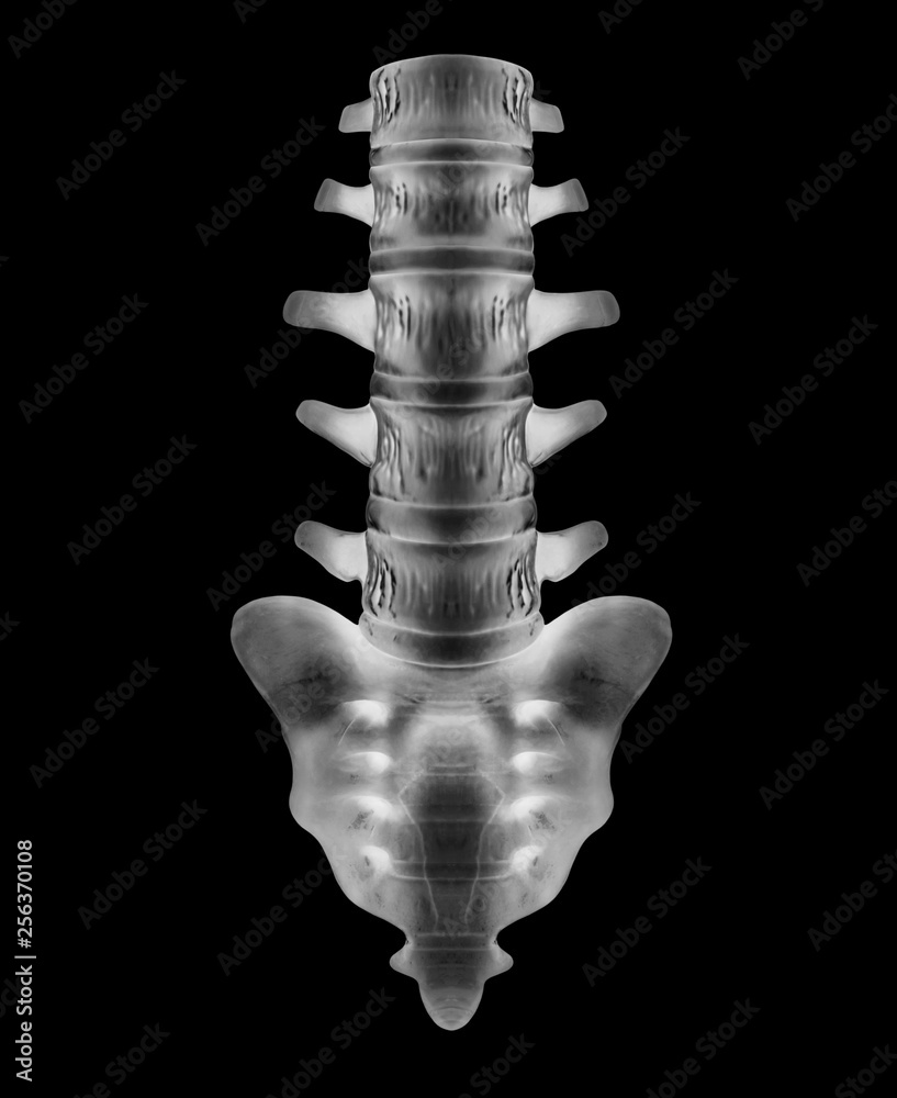 X-ray of human backbone- Lumbar Spine- Sacrum And Coccyx Anterior view ...