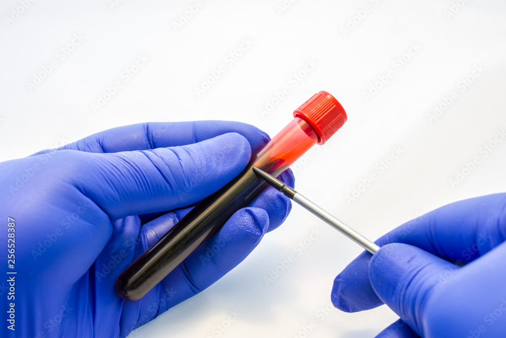 Doctor or scientist holds in gloved hand laboratory tube with blood and ...