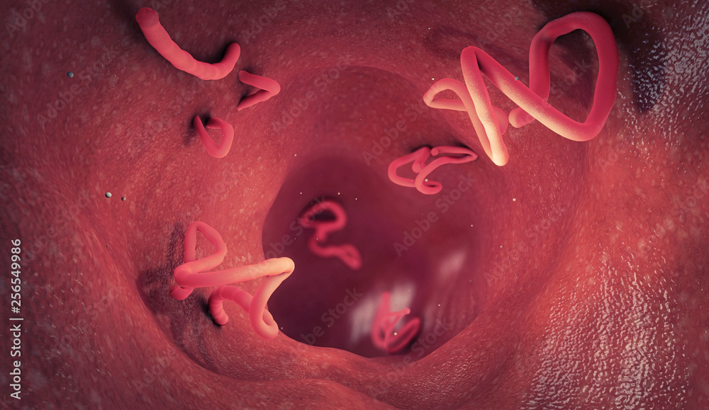 Tapeworm infestation in a human intestine - 3d illustration Stock ...