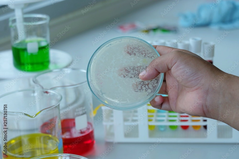 Petri dish for culture in laboratories. and Bacterial colonies culture ...