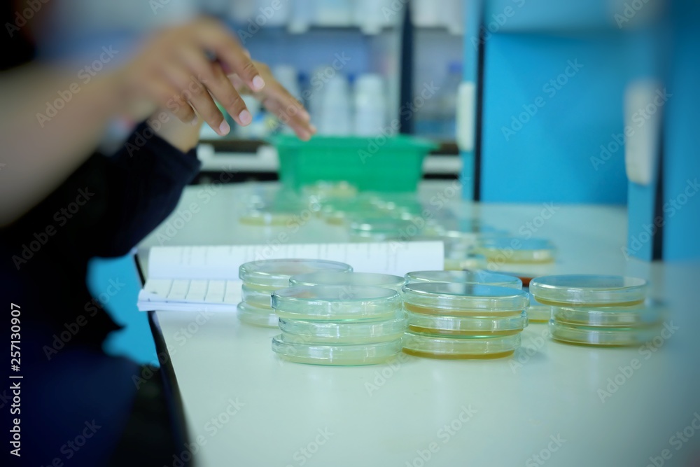 Petri dish for culture in laboratories. and Bacterial colonies culture ...