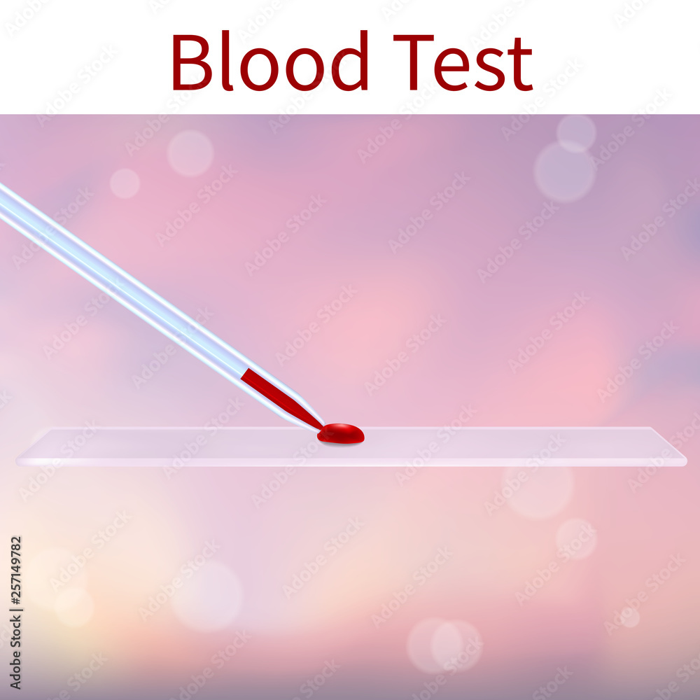 Blood test. Vector medical illustration. Droplet, capillary tube, slide ...