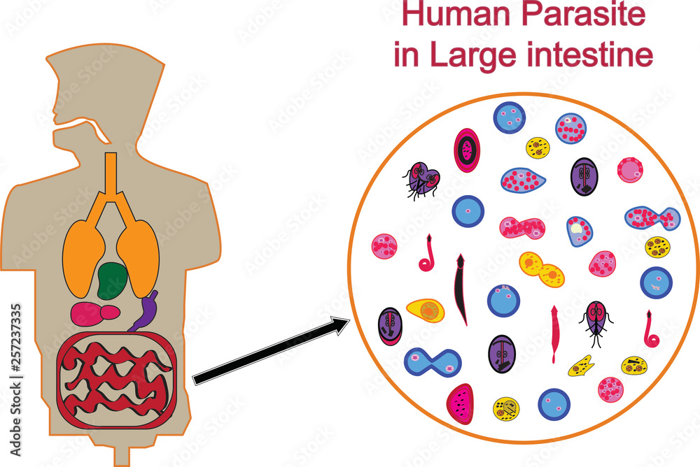 Human Parasite in Large intestine.Medical Parasitology.Parasitic ...
