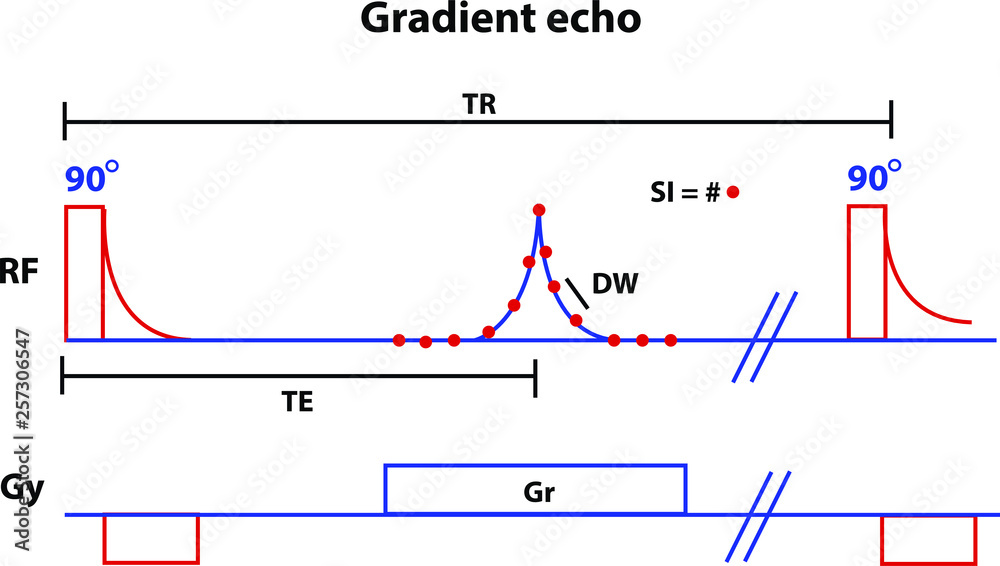 Schematic diagram vector of a gradient echo used for MRI and NMR Stock ...