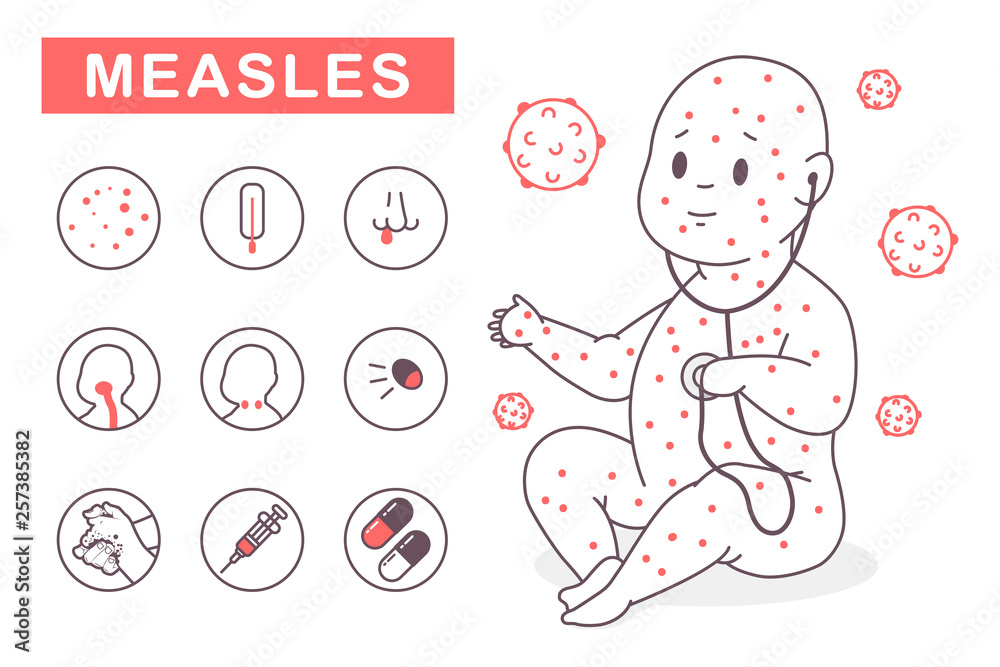 Measles vector infographics. Child character with a rash and icons with ...