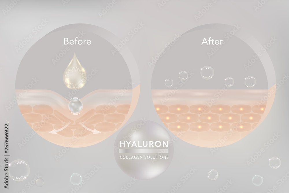 Hyaluronic acid skin solutions ad, white collagen serum drop with ...