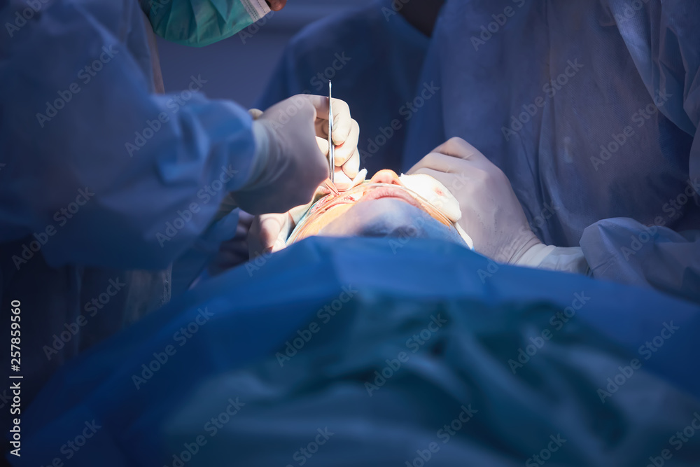 Surgical team performing surgery in modern operation theater,Team of ...