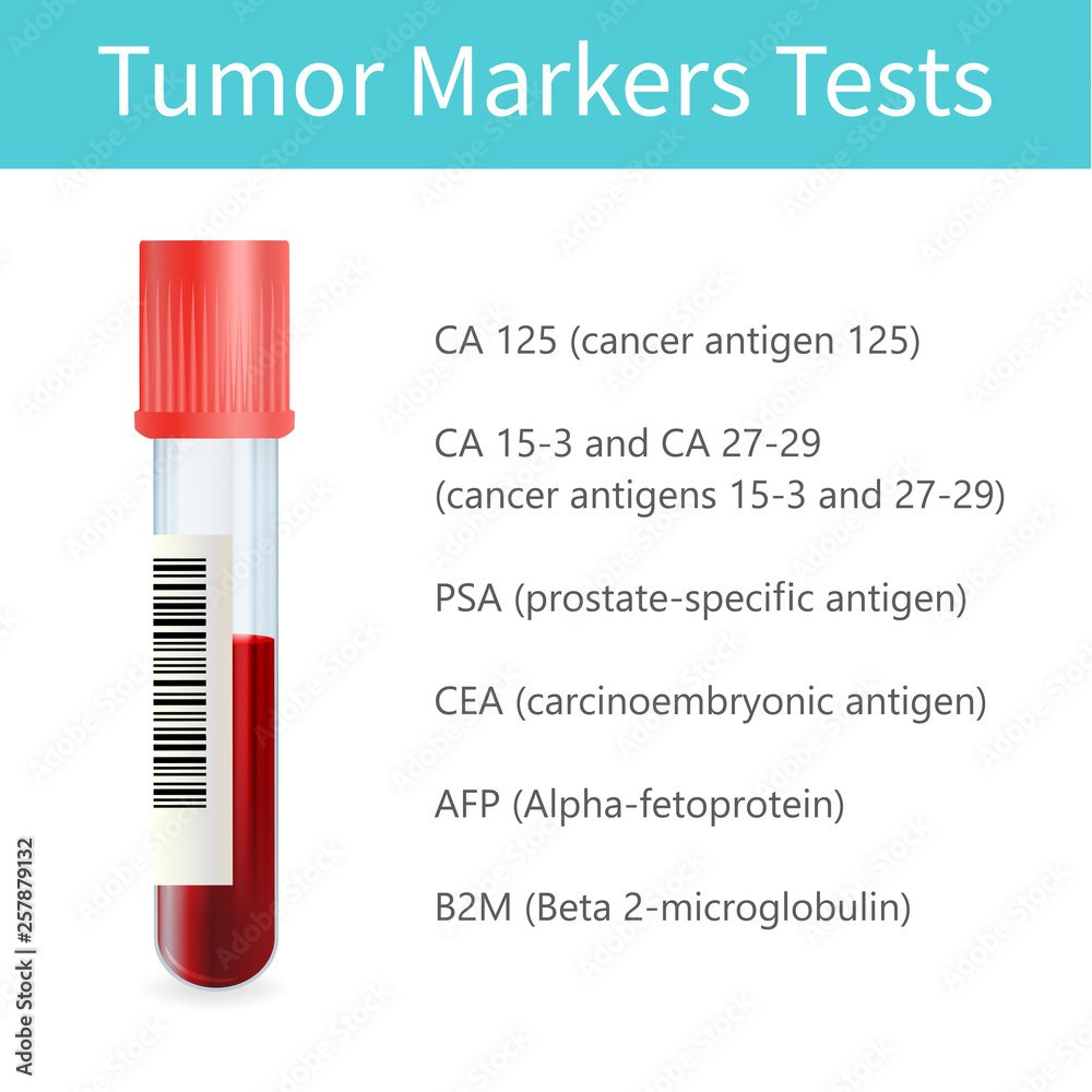 Blood cancer tumor marker test. Vector medical illustration. White ...