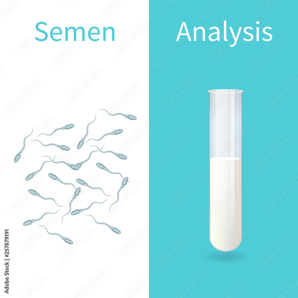 Semen Analysis. Spermogram. Test tube, sperm. Vector medical ...