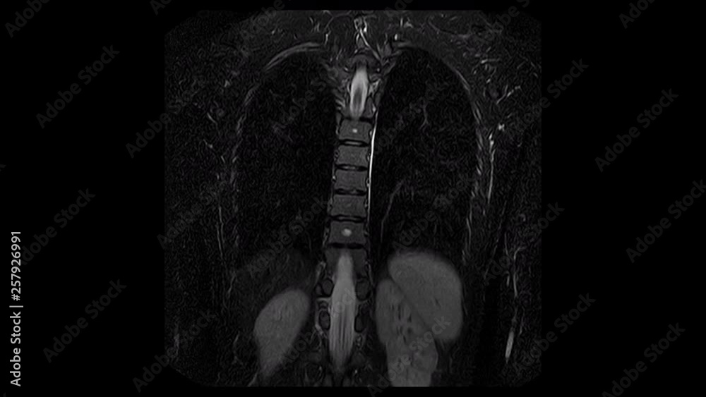Computed medical tomography MRI upscaled scan of healthy young female ...