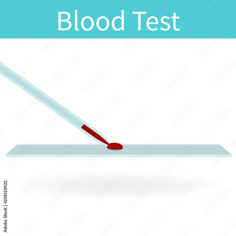Blood test. Vector flat medical illustration. Droplet, capillary tube ...