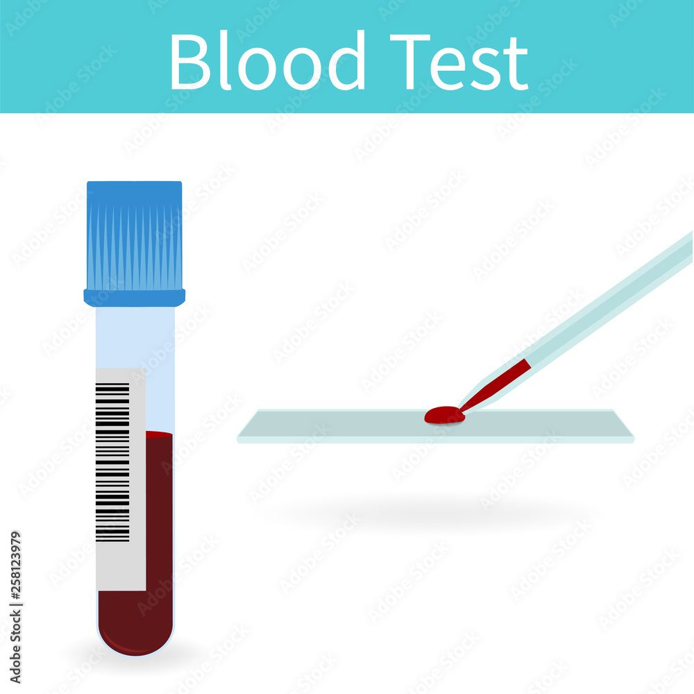 Blood test. Vector flat medical illustration. Droplet, capillary, tube ...