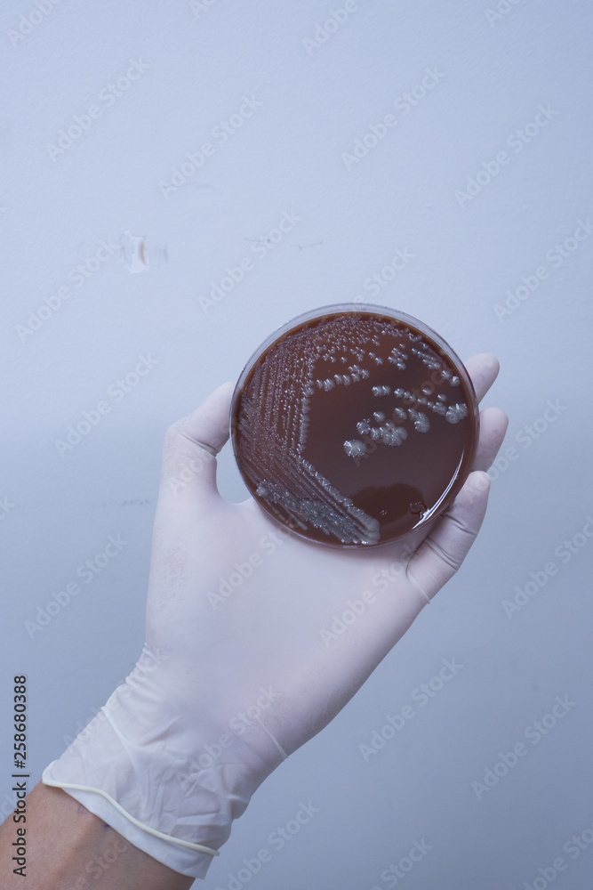 Bacteria colonies on Chocolate agar Stock Photo | Adobe Stock