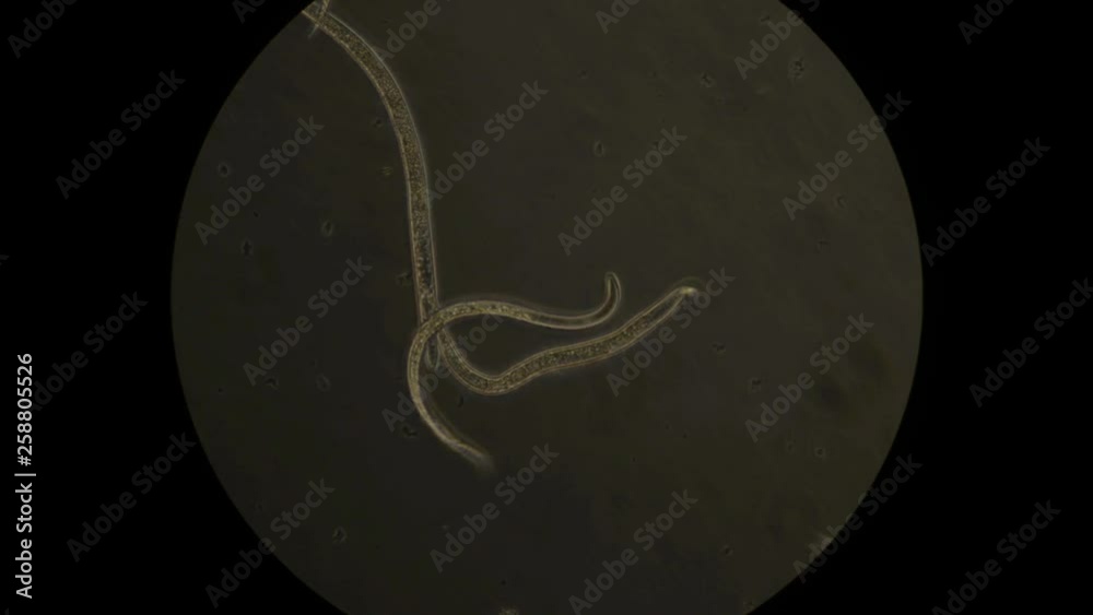 Soil nematode as seen under microscope Stock Video | Adobe Stock