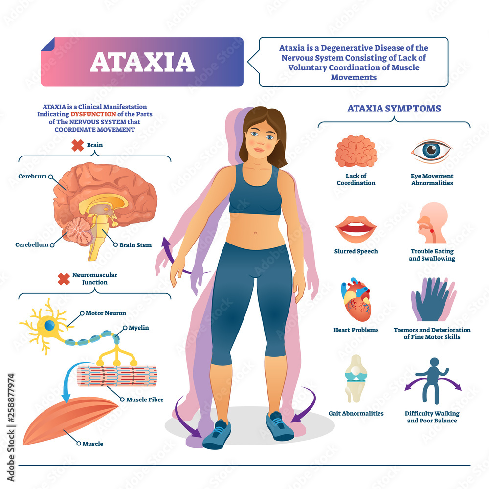 Ataxia vector illustration. Labeled medical movement brain disorder ...