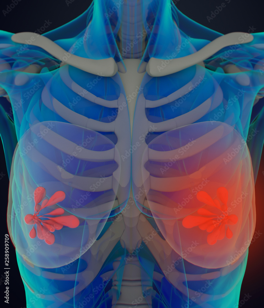 Female breasts anatomy breast cancer. 3d illustration Stock ...