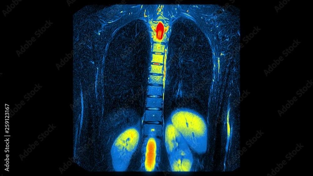 Computed medical tomography MRI upscaled scan of healthy young female ...