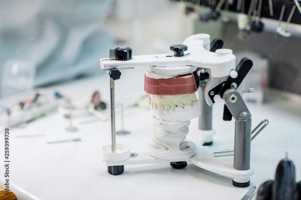 Prototypes of false teeth, creation of teeth, devices of prosthetics ...