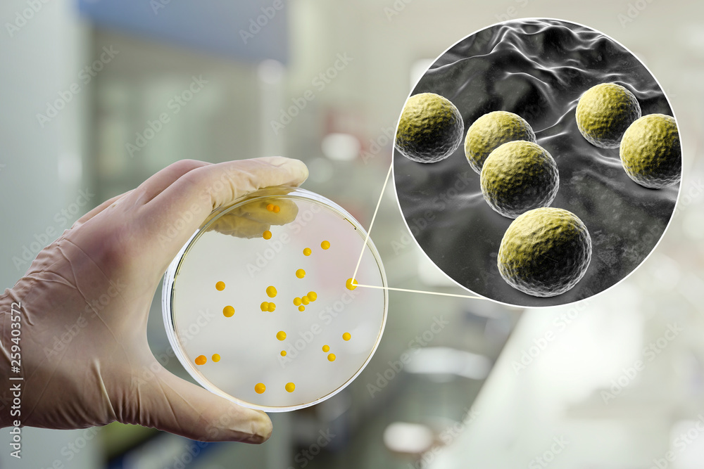 Colonies of Micrococcus luteus bacteria on agar plate and close up view ...