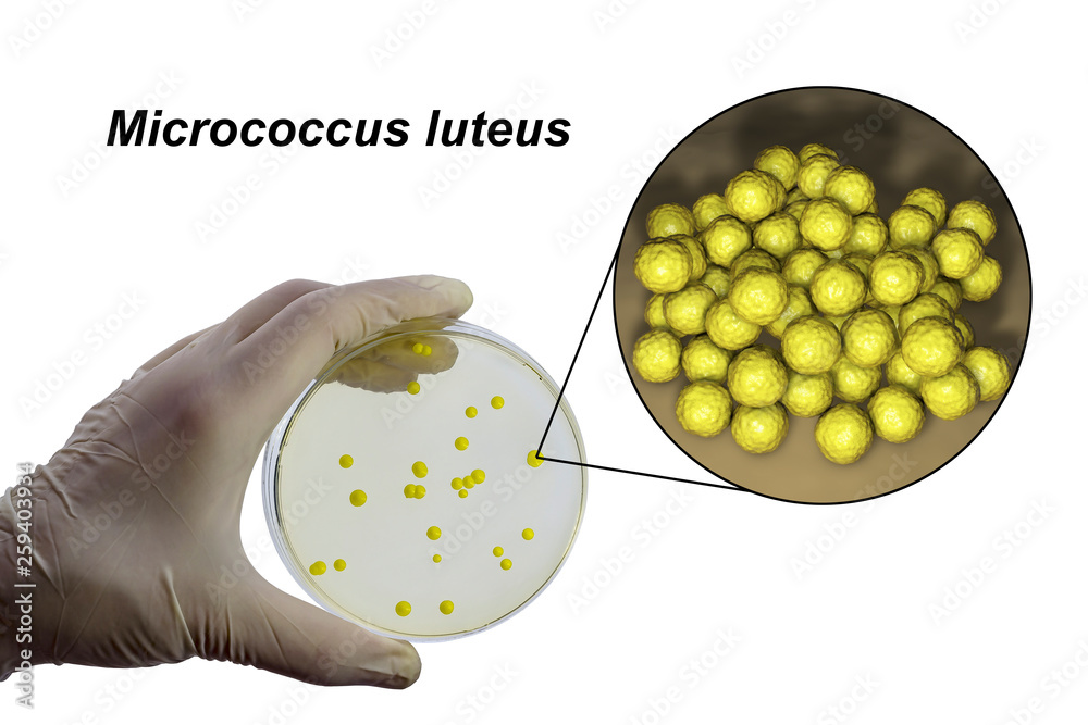 Colonies of Micrococcus luteus bacteria on agar plate and close up view ...