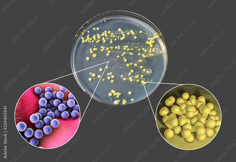 Staphylococcus Epidermidis Agar Plate