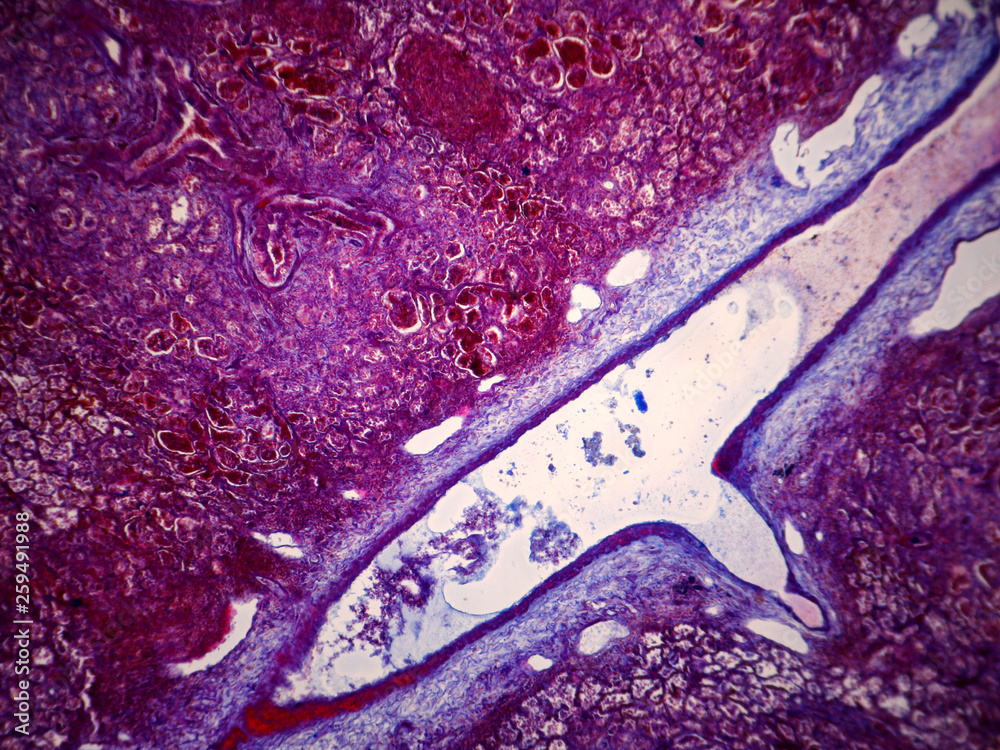 Sheep lung parasitized by lung worms 스톡 사진 | Adobe Stock
