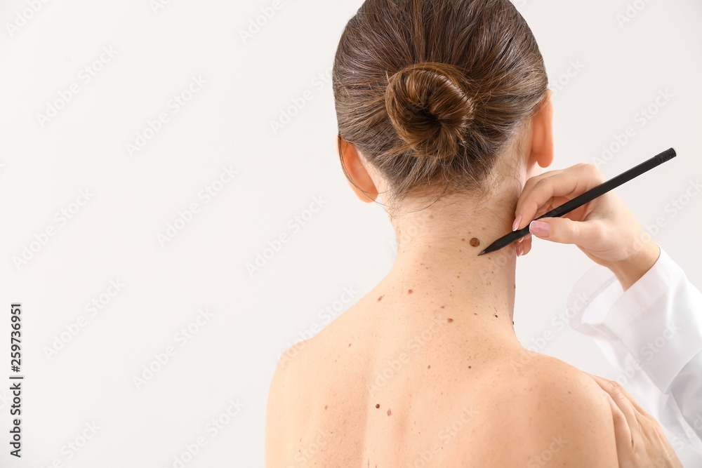 Dermatologist applying marks onto patient's skin before moles removal ...