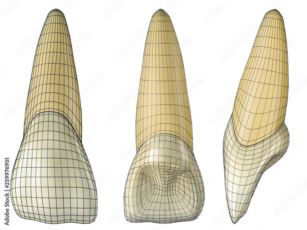 maxillary central incisor tooth in the vestibular, palatal and lateral ...