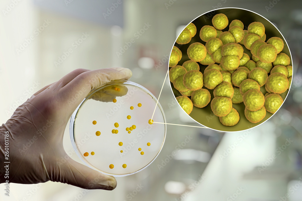 Colonies of Micrococcus luteus bacteria on agar plate and close up view ...