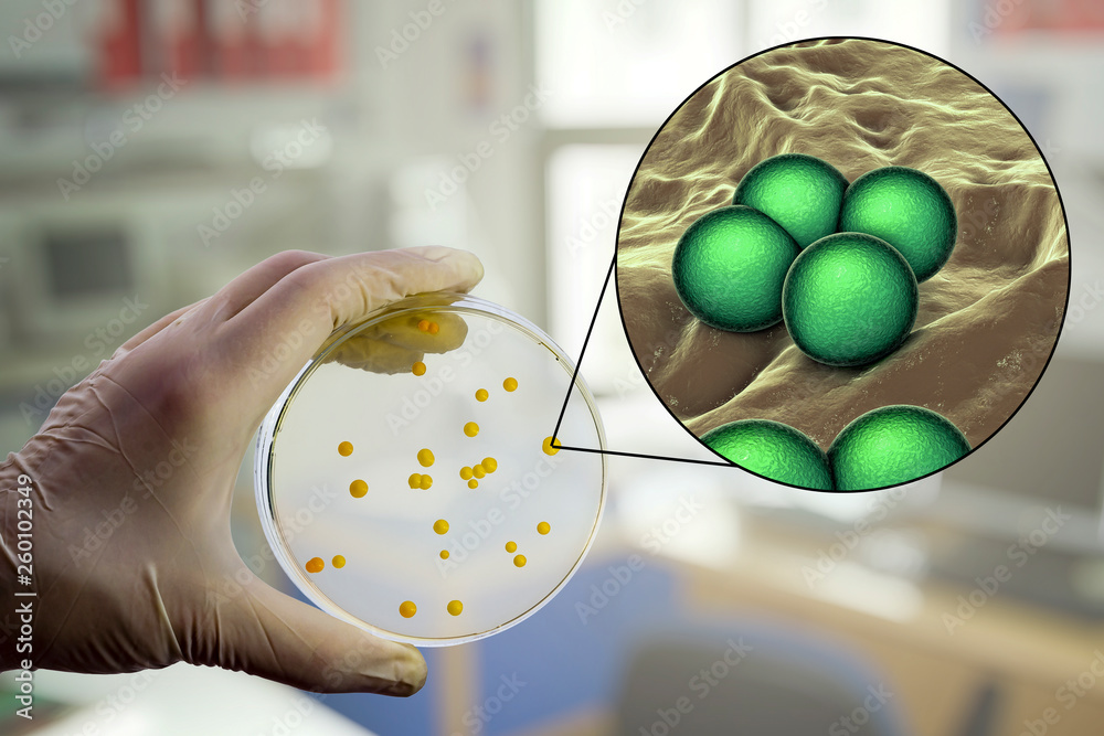 Colonies of Micrococcus luteus bacteria on agar plate and close up view ...