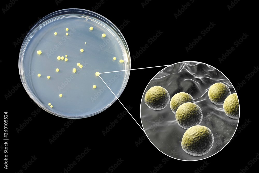 Colonies of Micrococcus luteus bacteria on agar plate and close up view ...