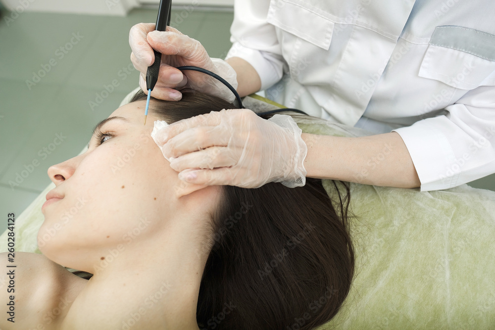 Medical Treatment Removal Of Birthmark From Female Patients Face