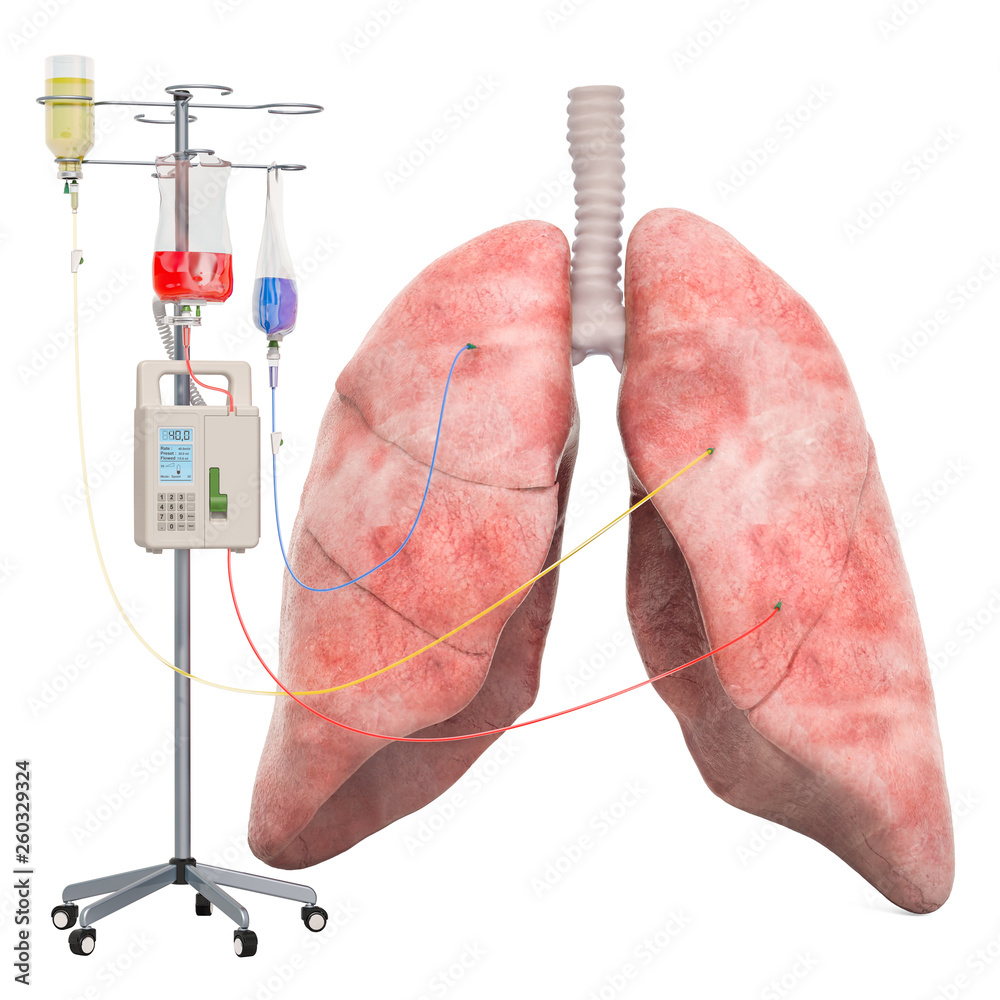 Intravenous therapy system with human lung. Treatment of Lung Disease ...