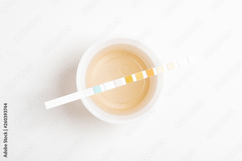 A set of urine sample on a round plastic cup with a single unused urine ...