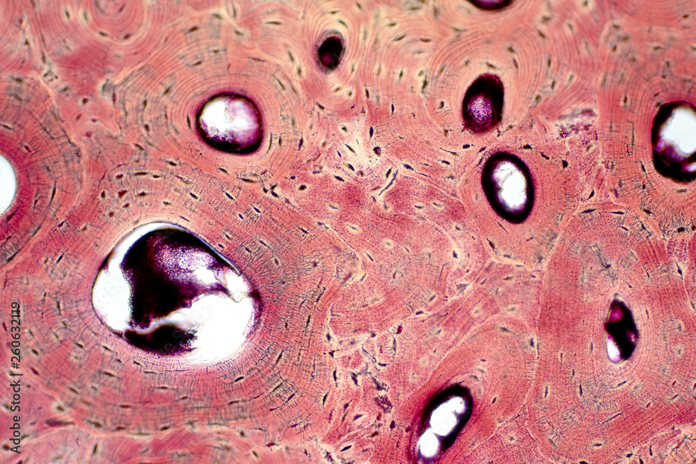 Histology of human compact bone tissue under microscope view for ...