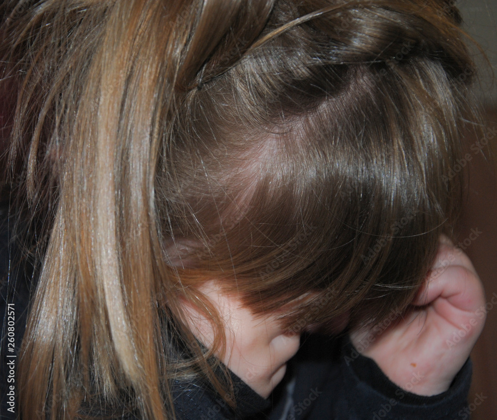 Niña triste llorando con la cabeza agachada frotándose los ojos Stock ...