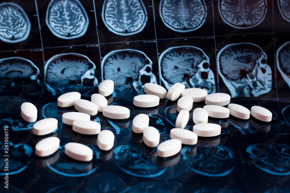 White pharmaceutical medicine pills on magnetic brain resonance scan ...