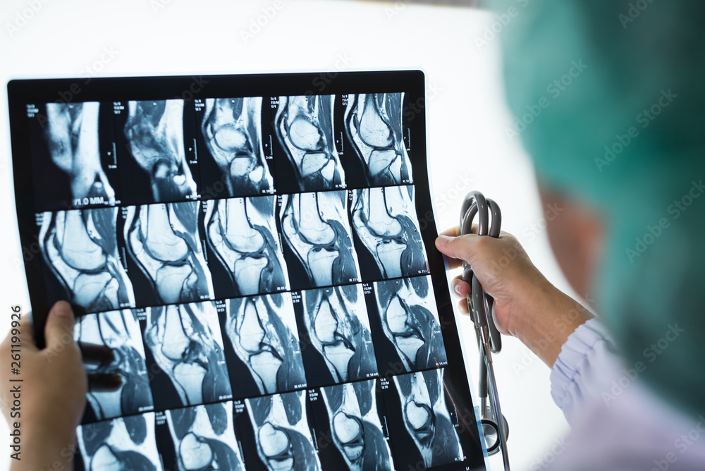 Doctor hand holding patient bone x-ray film and stethoscope before ...