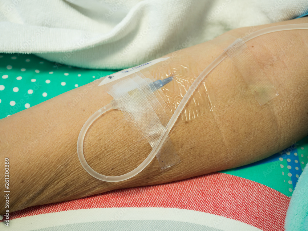 Patient arm and set iv fluid intravenous drop saline drip in hospital ...