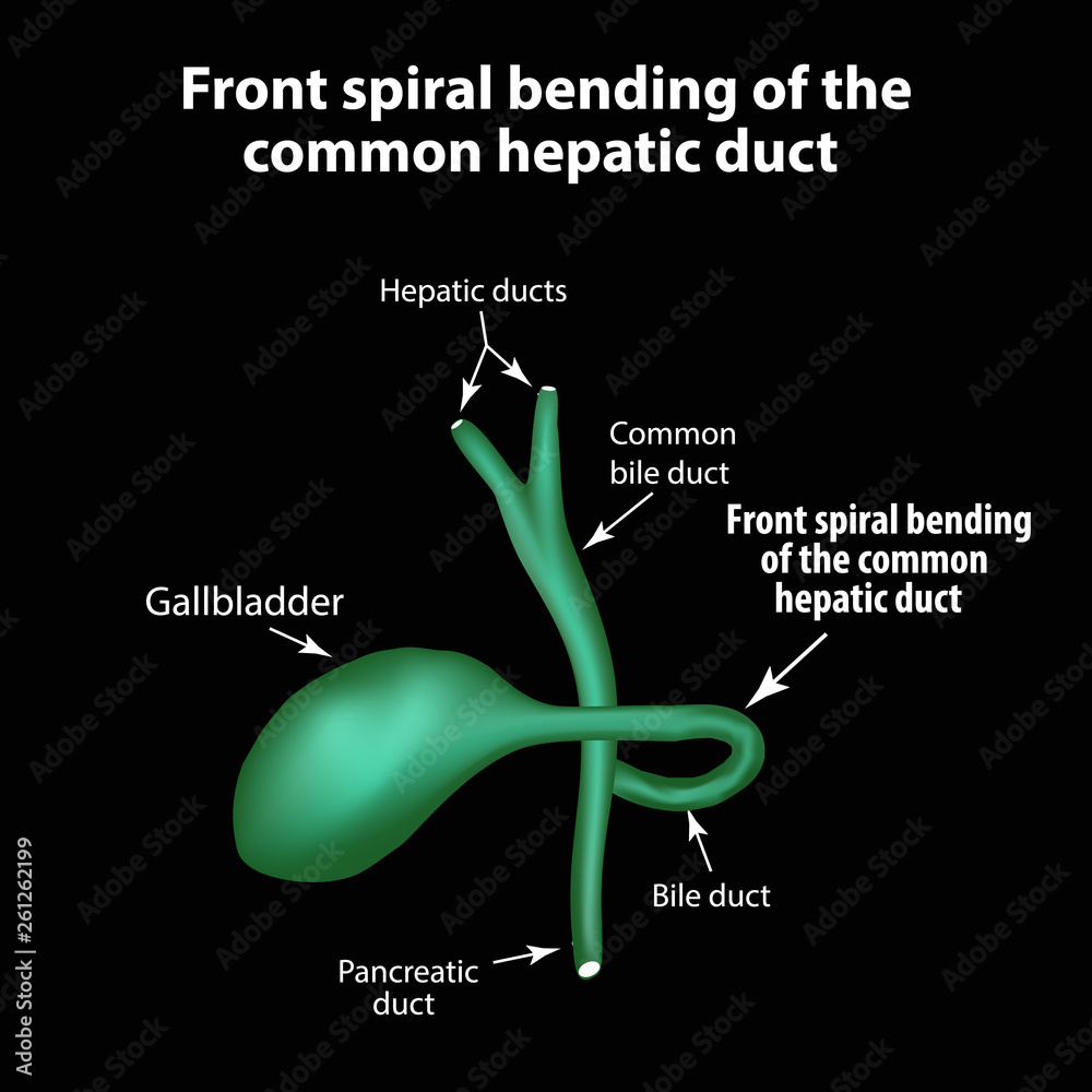 Front spiral bending of the common hepatic duct. Pathology of the ...