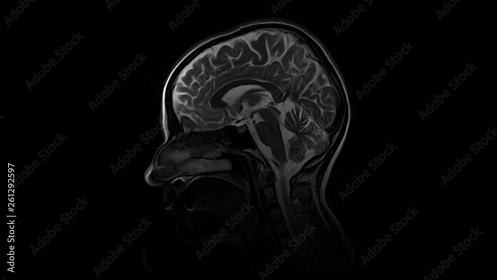 Computed medical tomography MRI upscaled scan of healthy young female ...