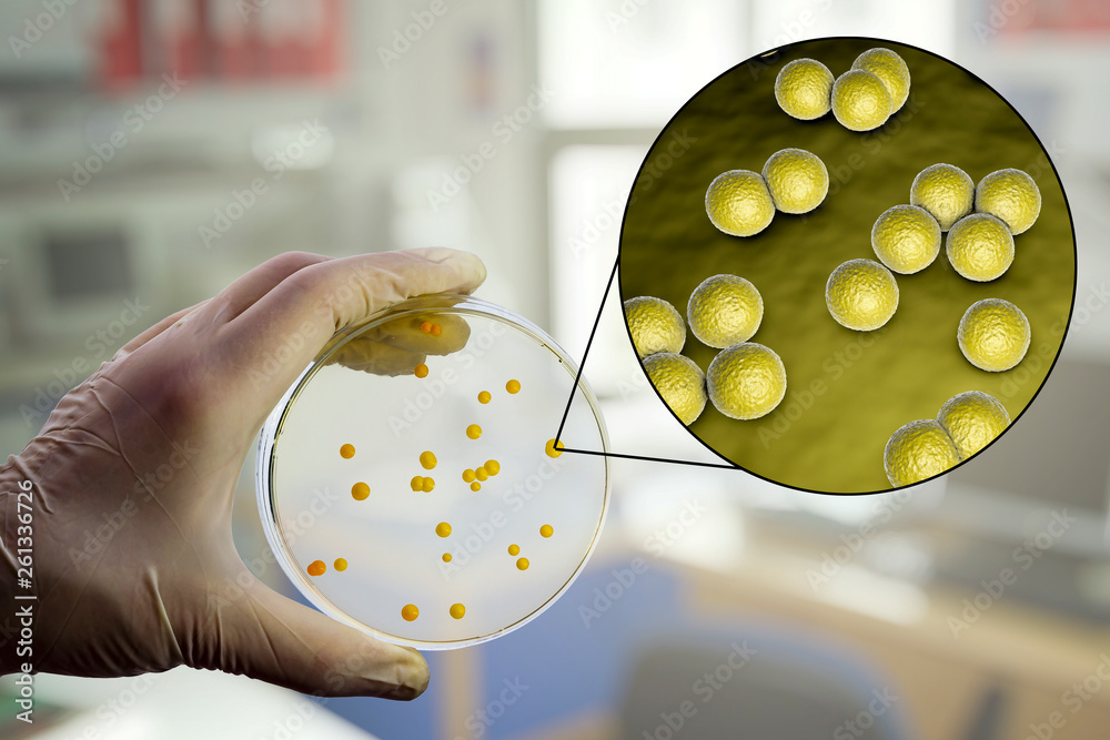 Colonies of Micrococcus luteus bacteria on agar plate and close up view ...