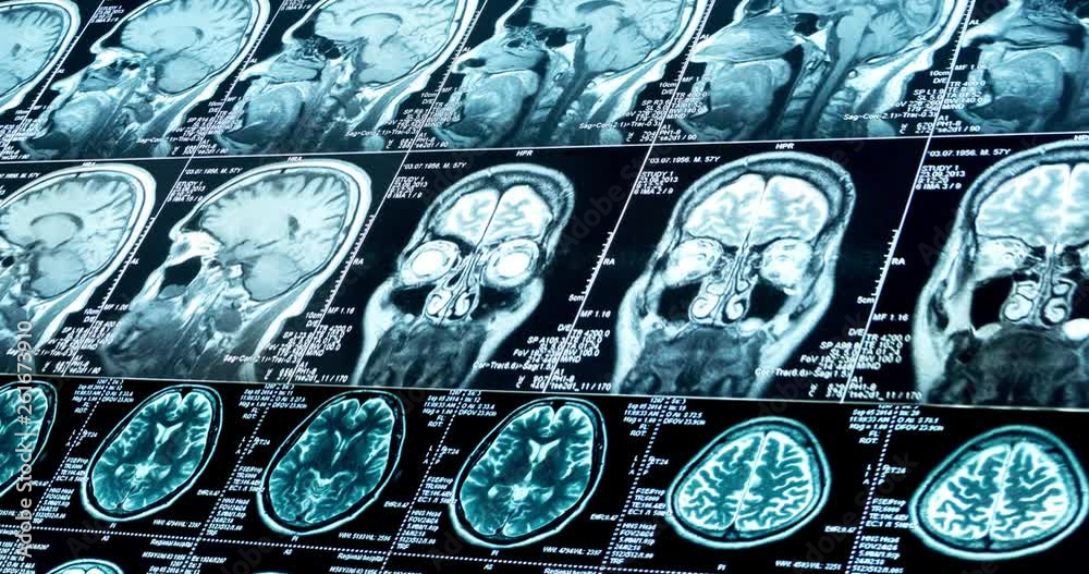 MRI scans of various sizes are moving diagonally, looped Stock Video ...