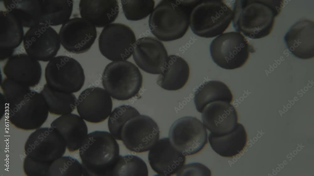 Eggs of brine shrimp under microscope. The microscopic world. Artemia ...