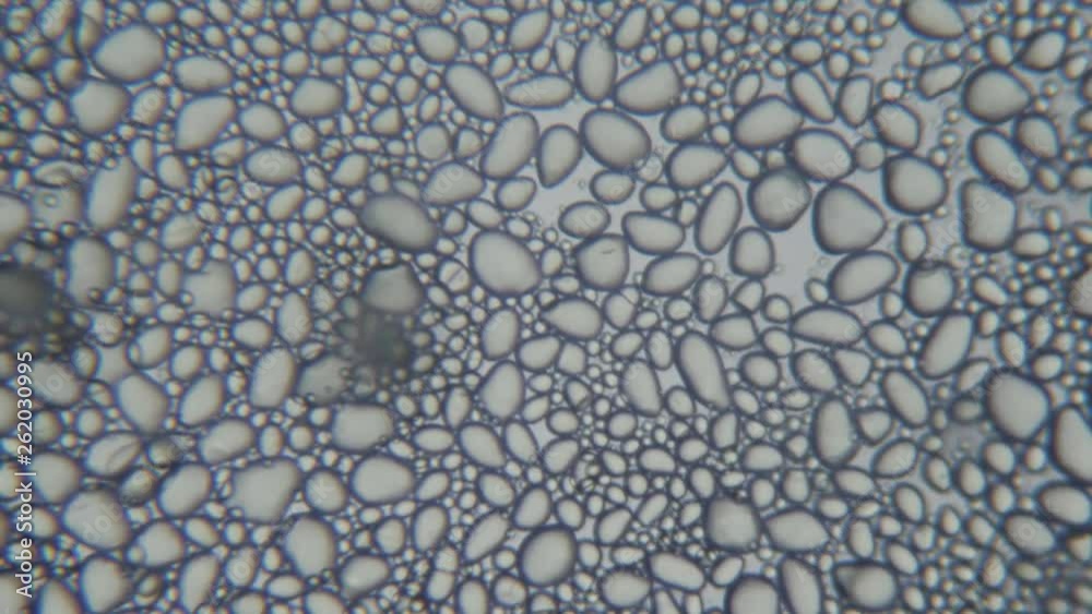 Highly magnified starch granules from a potato. Close up. Potato starch ...