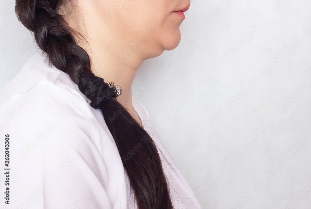 Beautiful girl on a white background whose problem on the face is ...