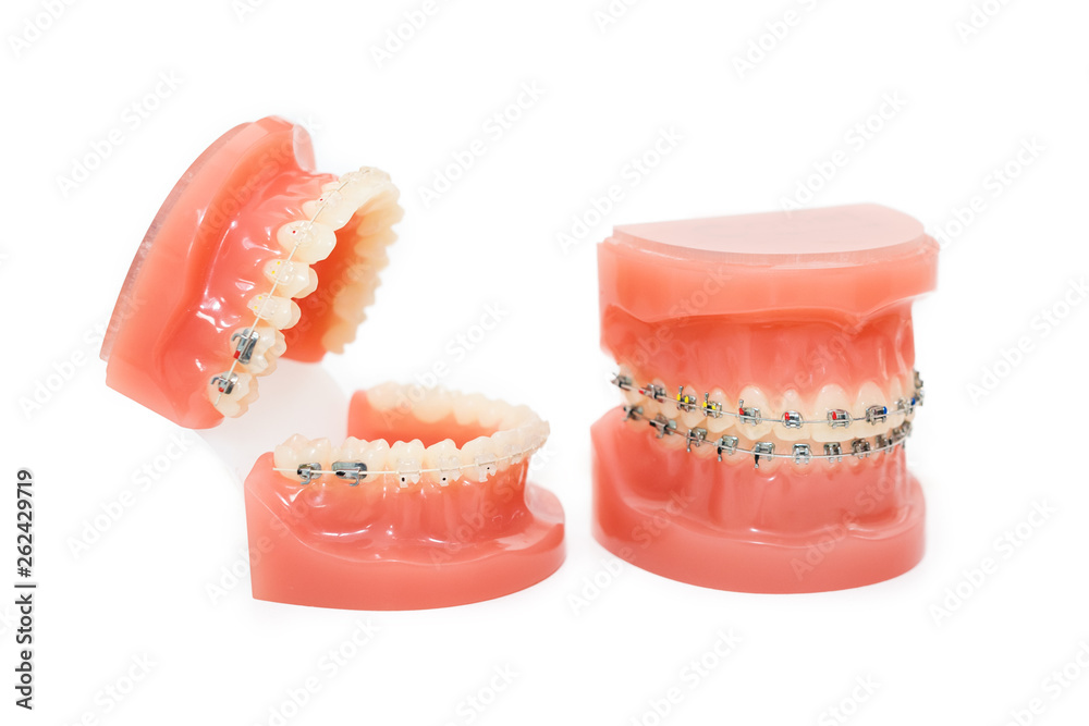 Orthodontic model and dentist tool - demonstration teeth model of ...
